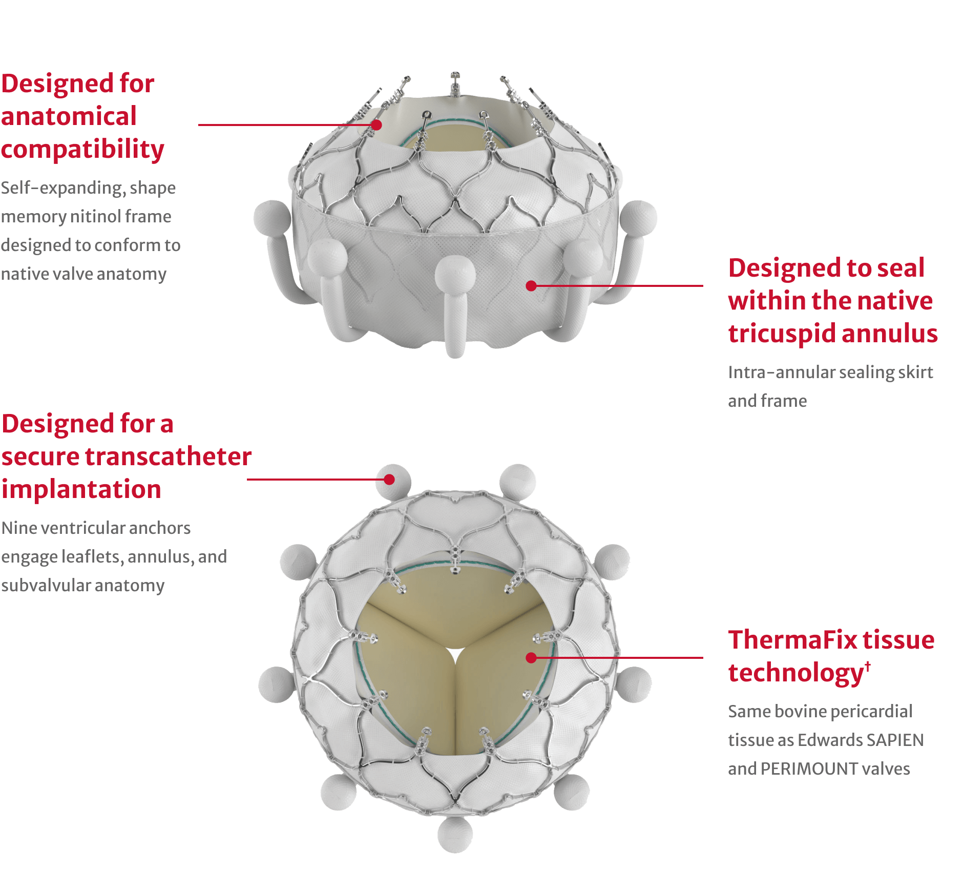 Evoque Tricuspid Valve Replacement Edwards Lifesciences